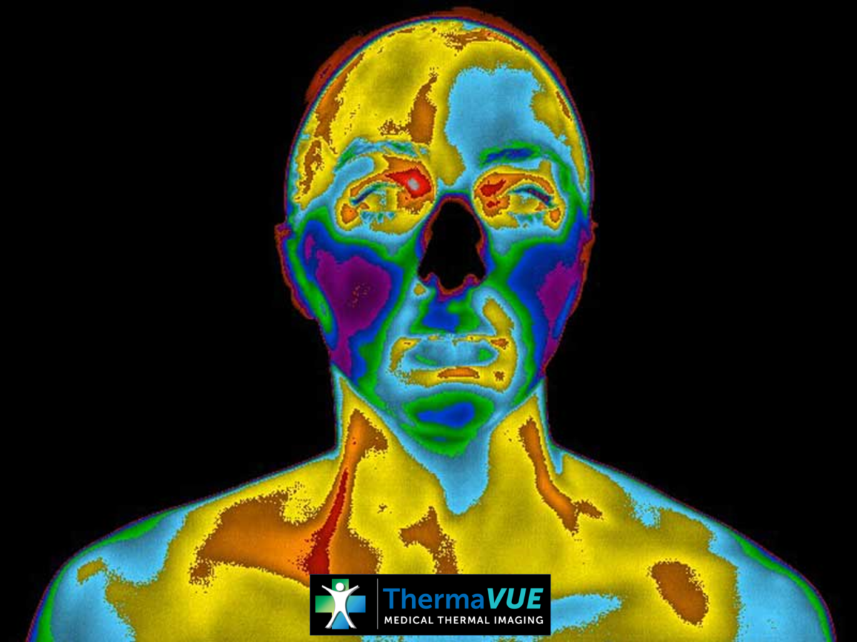 Body Imaging Case Studies - ThermaVUE