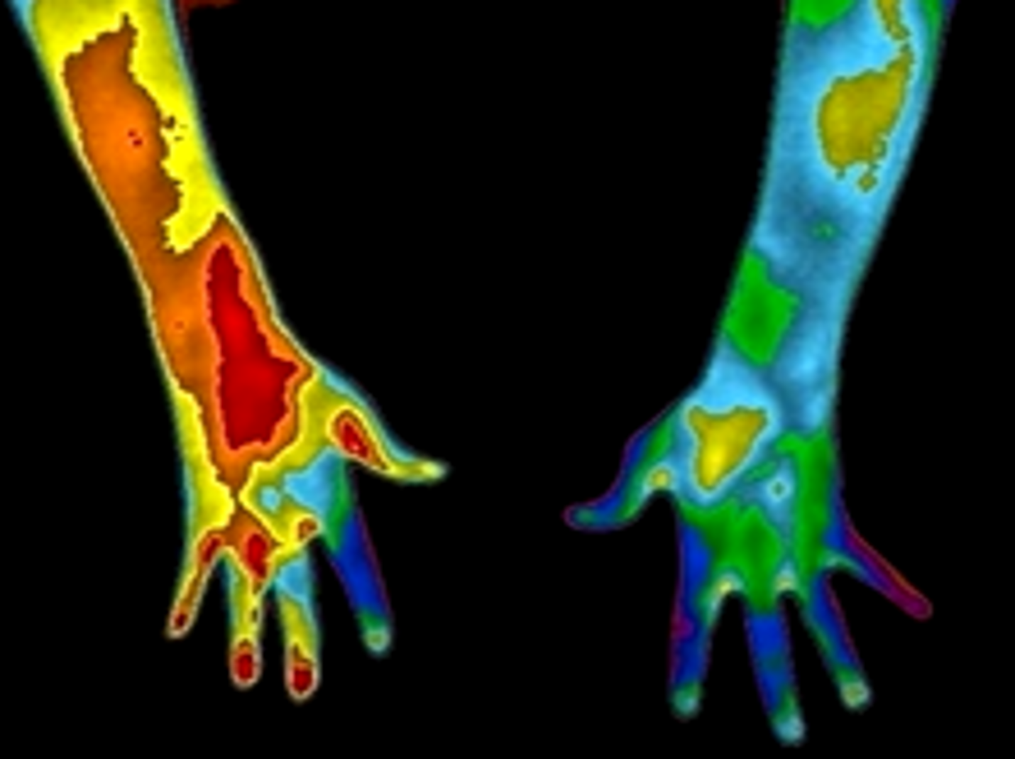 Body Imaging - ThermaVUE